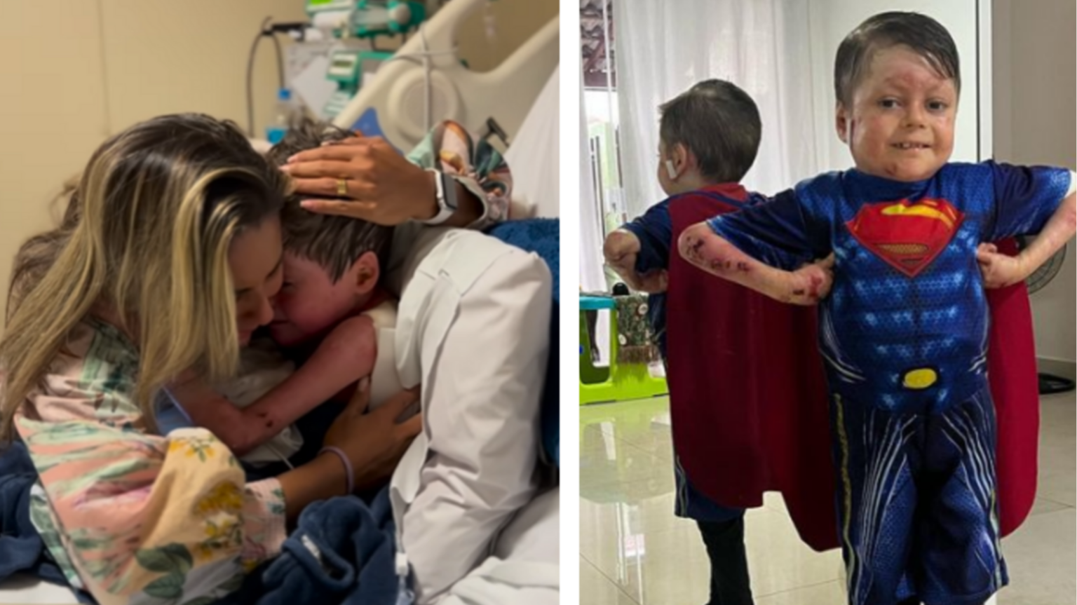 Niño con piel de mariposa tiene emotivo reencuentro con su mamá tras 16 ...