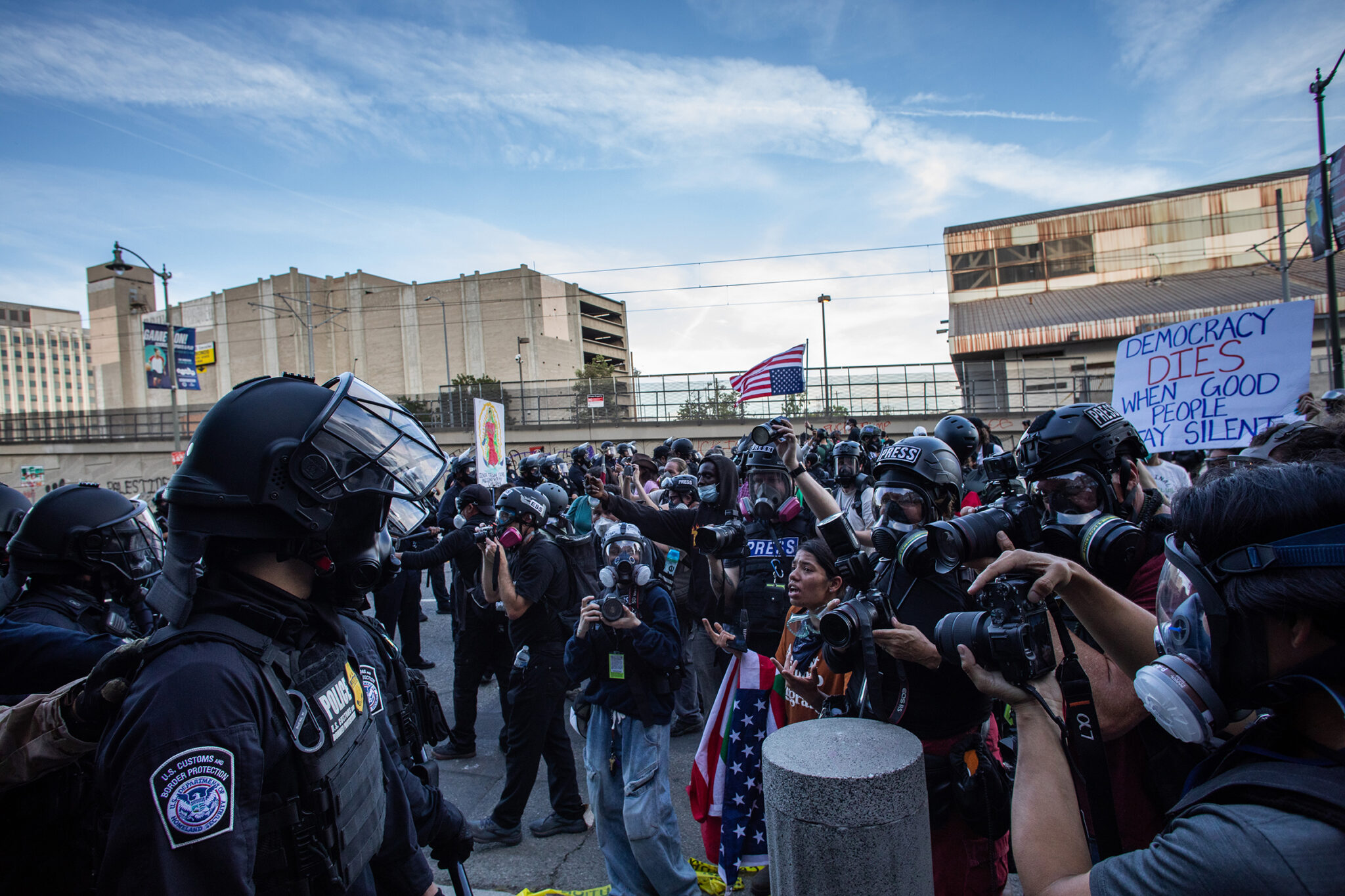 Teen loses eye after being shot while photographing protest